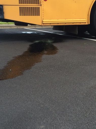 WARNING: Graphic Photos Show Students' Burns From School Bus ...
