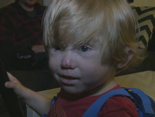 Toddler with Vampire-like Symptoms Fights for a Cure | wfmynews2.com